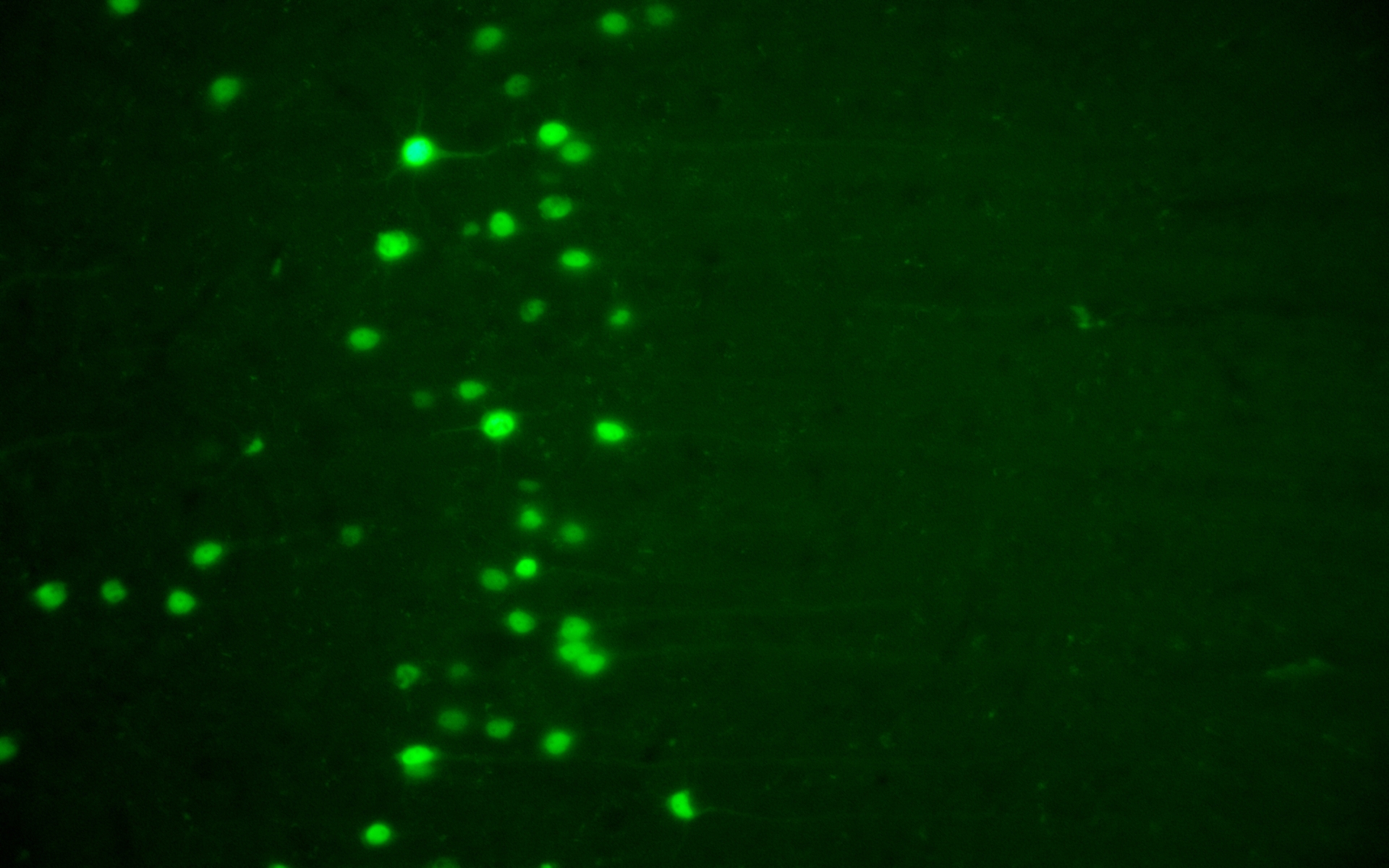 Addgene: AAV Data Hub - pENN.AAV.hSyn.Cre.WPRE.hGH in Rat (AAV Retrograde)